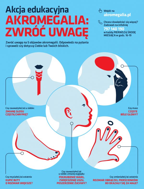 Akromegalia: infolinia już działa! - Medycyna - różne artykuły ...